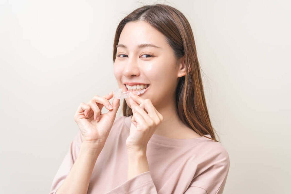 How Much Does Invisalign Cost? Everything You Need to Know - Good ...